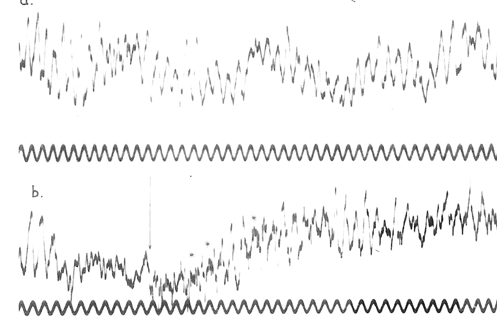 Die Gehirnwellen - IFEN Neurofeedback Blog