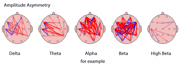 Quantitative EEG-Analysis - IFEN Neurofeedback Blog