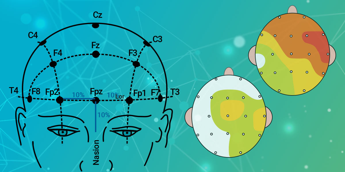 Quantitative EEG-Analysis - IFEN Neurofeedback Blog