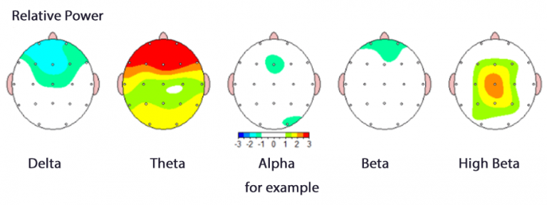 Quantitative EEG-Analysis - IFEN Neurofeedback Blog